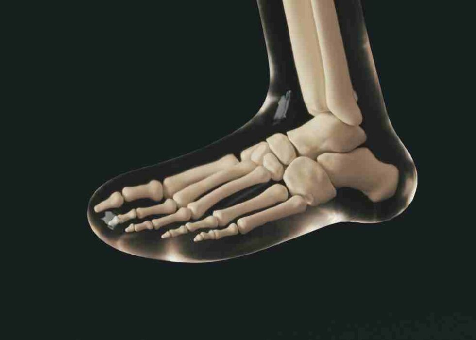 Douleur au talon : Causes, symptômes et traitement - santechiro.fr